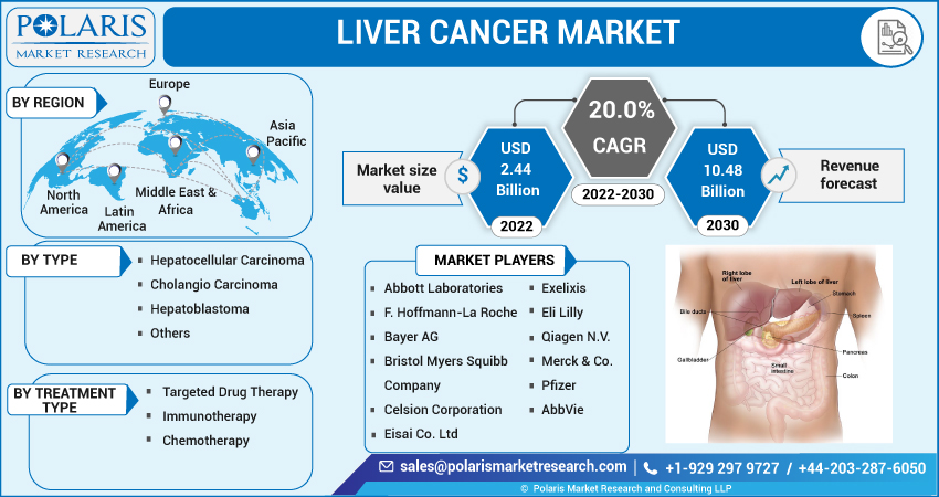 Liver Cancer Market Size Global Report, 2022 - 2030