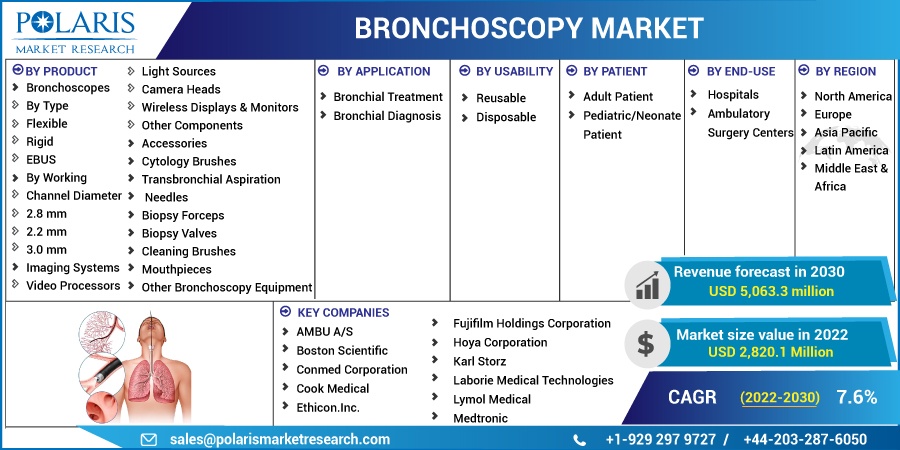 Bronchoscopy Market Size, Share Global Analysis Report, 2022-2030 Bronchoscopy Market Size, Share Global Analysis Report, 2022-2030
